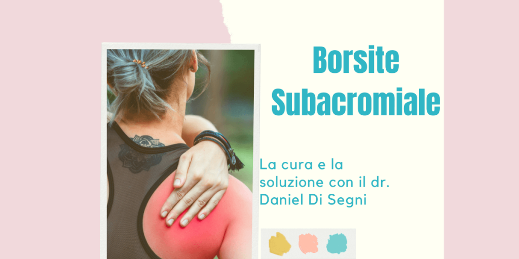 Borsite subacromiale SFIAMMA la tua spalla SENZA FARMACI
