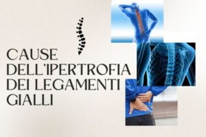 Legamento Giallo -Cos'è, funzione e come trattarlo per stare bene