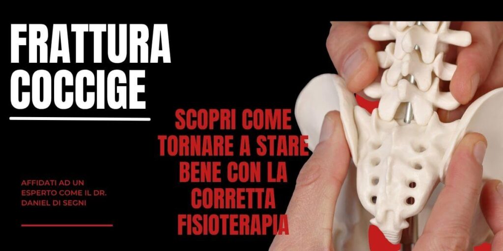 Coccige Fratturato: Come Riconoscerlo e Guarire in Fretta a Roma